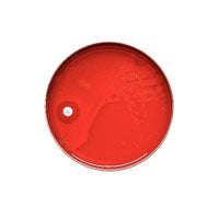 BD BD231046 BBL Taxo P Disc, for Differentiating Pneumococci – Owl ...
