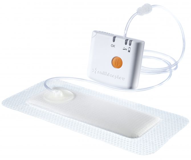 Smith & Nephew 66800954 Pico Negative Pressure Wound Therapy Kit, Sing ...